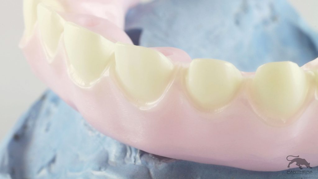 Panthera - Ceramet UK Dental Solutions