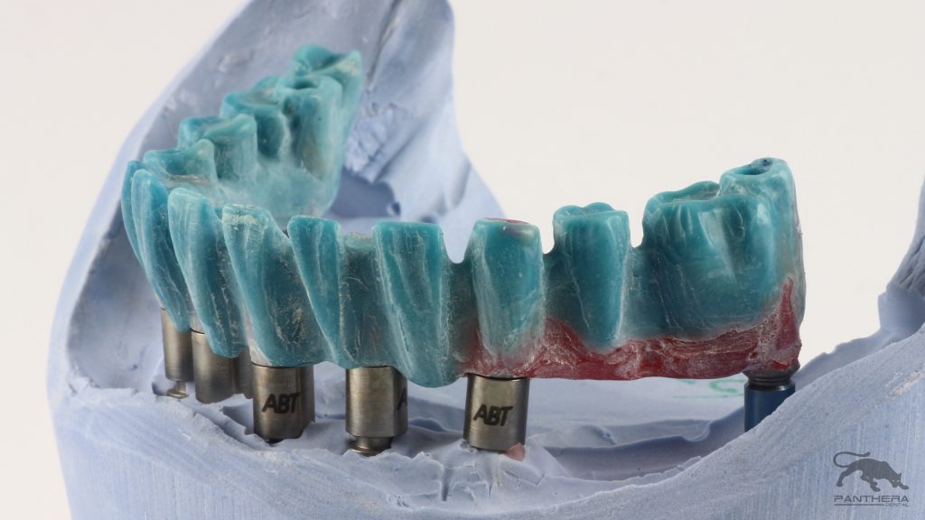 Panthera - Ceramet UK Dental Solutions