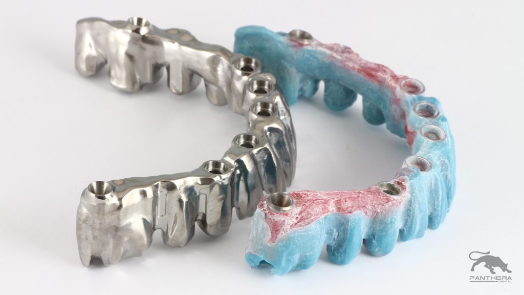 Panthera - Ceramet UK Dental Solutions