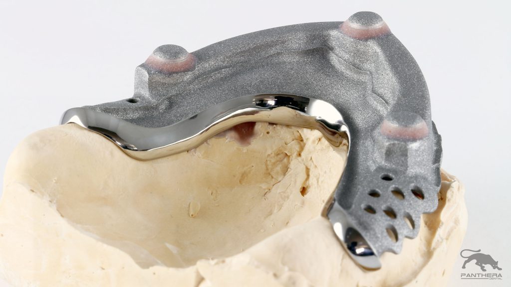 Panthera - Ceramet UK Dental Solutions