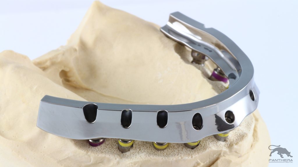 Panthera - Ceramet UK Dental Solutions