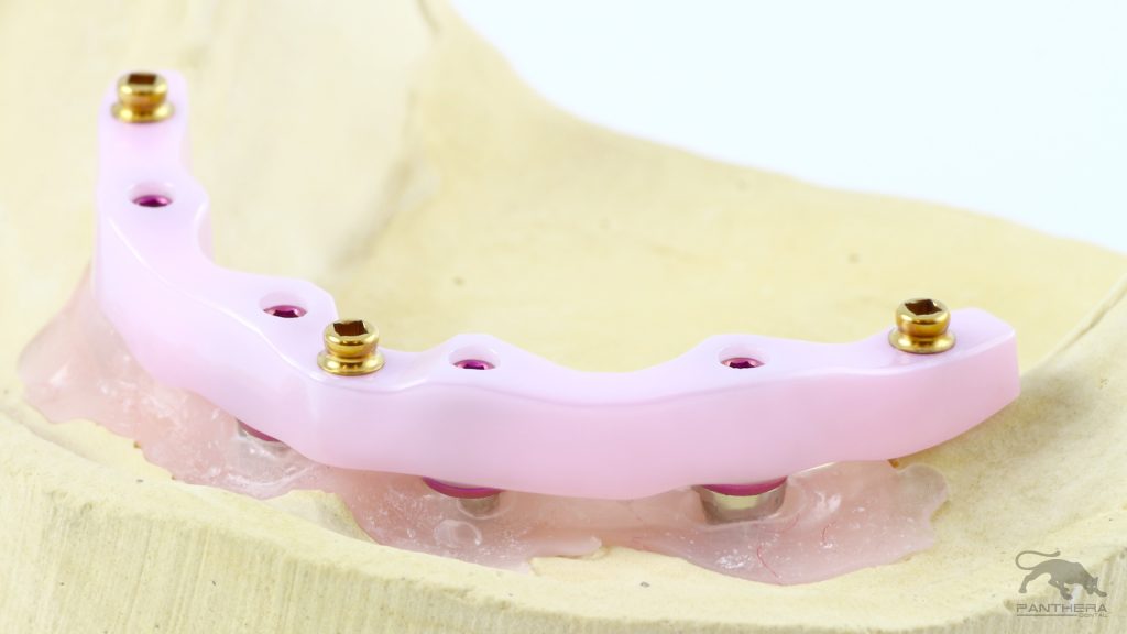 Panthera - Ceramet UK Dental Solutions