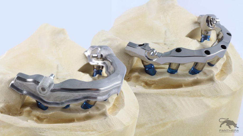 Panthera - Ceramet UK Dental Solutions