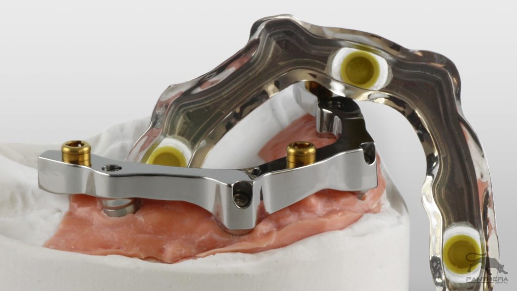 Panthera - Ceramet UK Dental Solutions