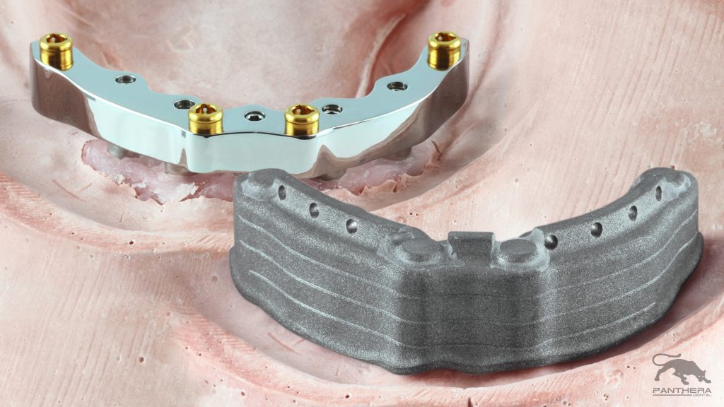 Panthera - Ceramet UK Dental Solutions