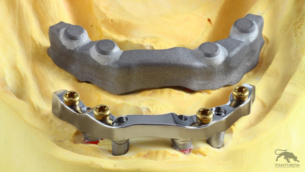 Panthera - Ceramet UK Dental Solutions