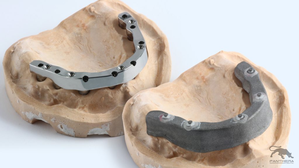 Panthera - Ceramet UK Dental Solutions