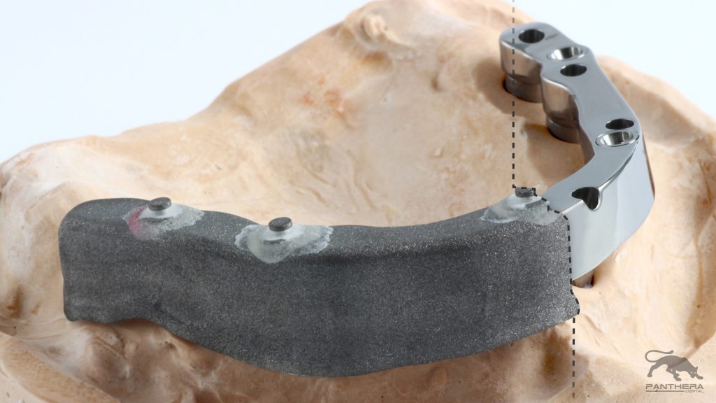 Panthera - Ceramet UK Dental Solutions
