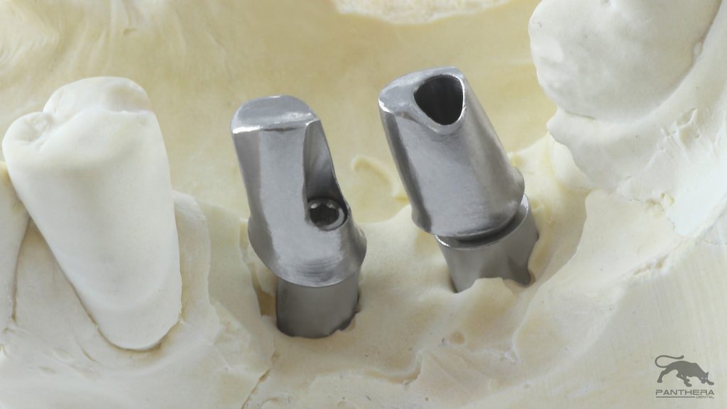 Panthera - Ceramet UK Dental Solutions
