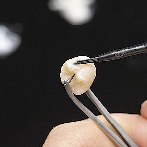 Soprano® Surface - Ceramet UK Dental Solutions