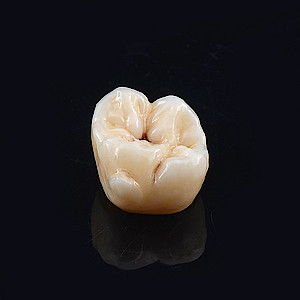 Soprano® Surface - Ceramet UK Dental Solutions