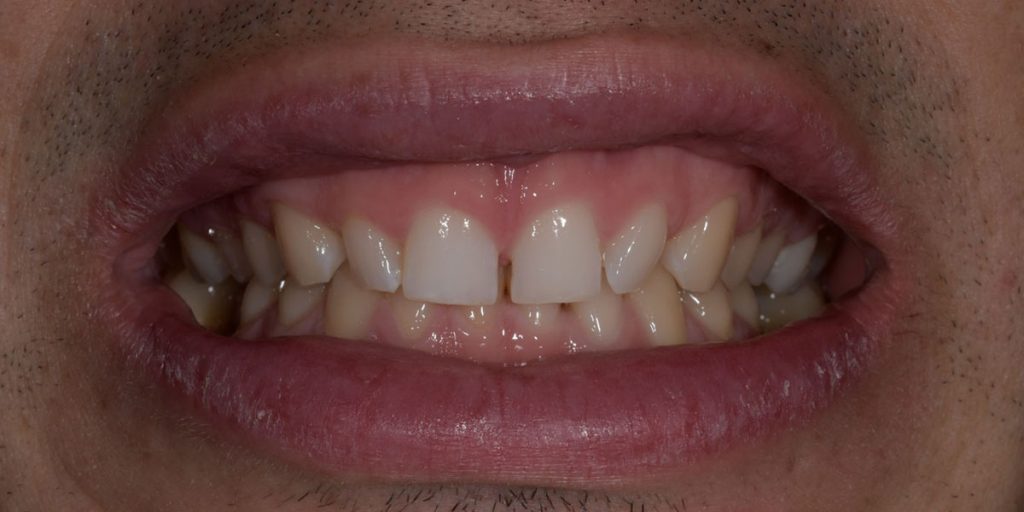 Creation - Ceramet UK Dental Solutions