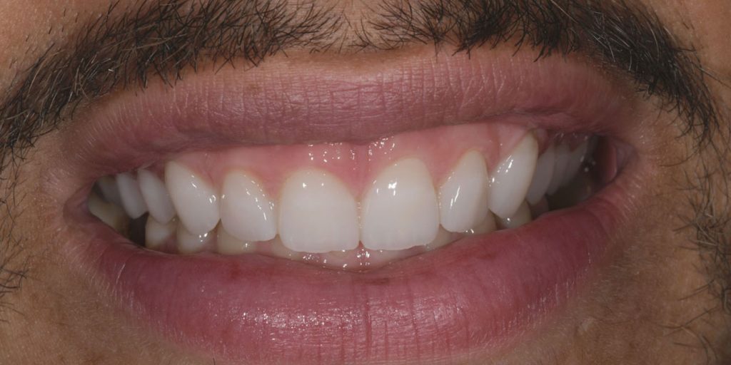 Creation - Ceramet UK Dental Solutions