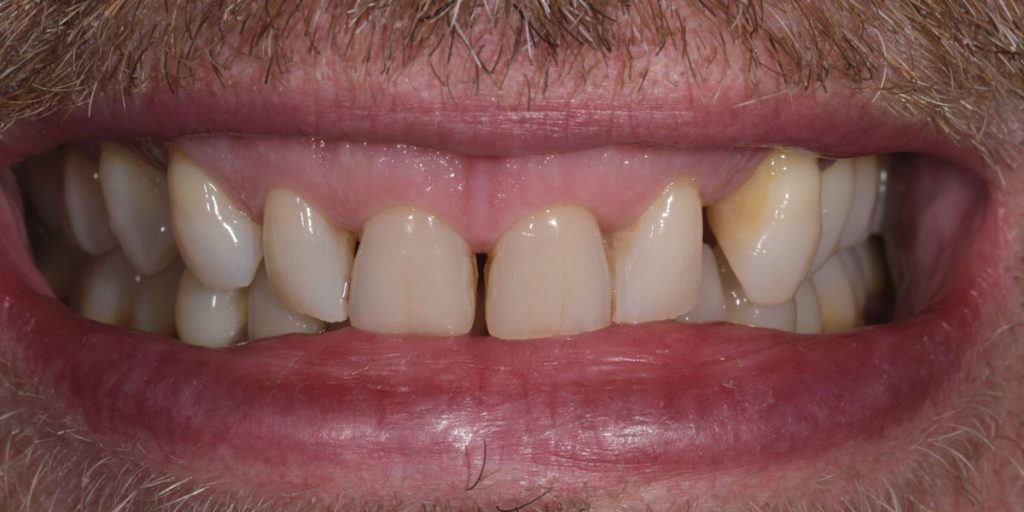 Creation - Ceramet UK Dental Solutions