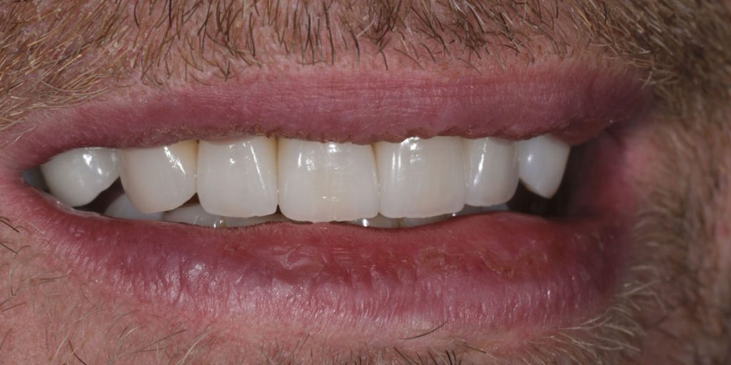 Creation - Ceramet UK Dental Solutions