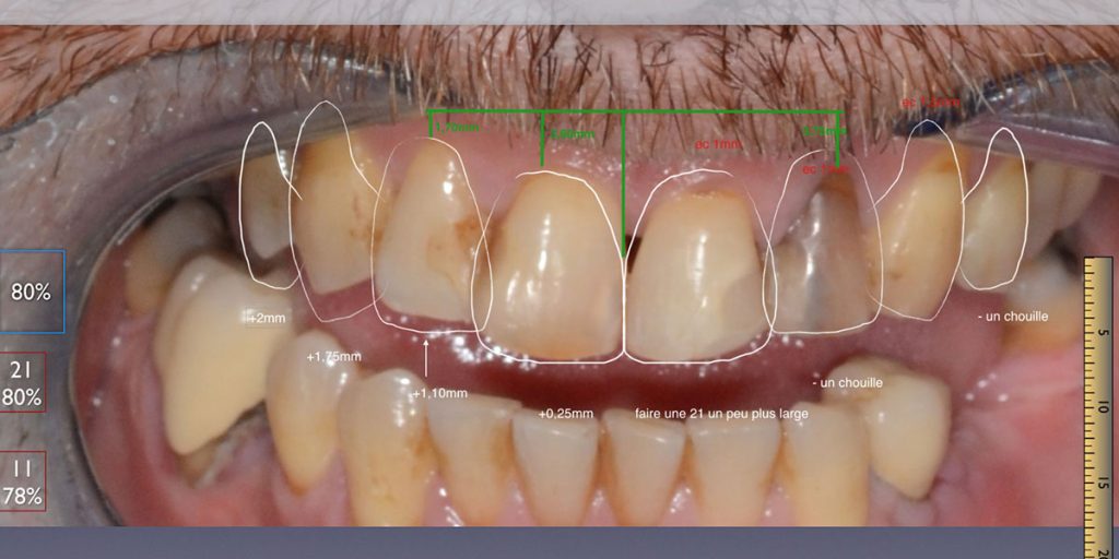 Creation - Ceramet UK Dental Solutions