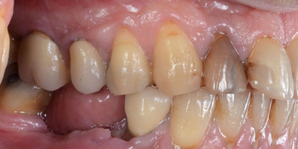 Creation - Ceramet UK Dental Solutions