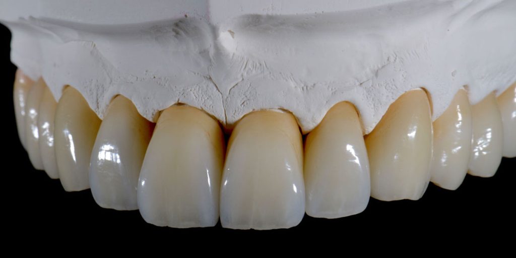 Creation - Ceramet UK Dental Solutions