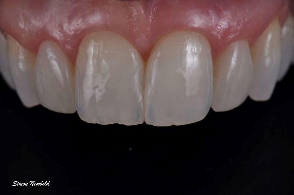 Creation - Ceramet UK Dental Solutions
