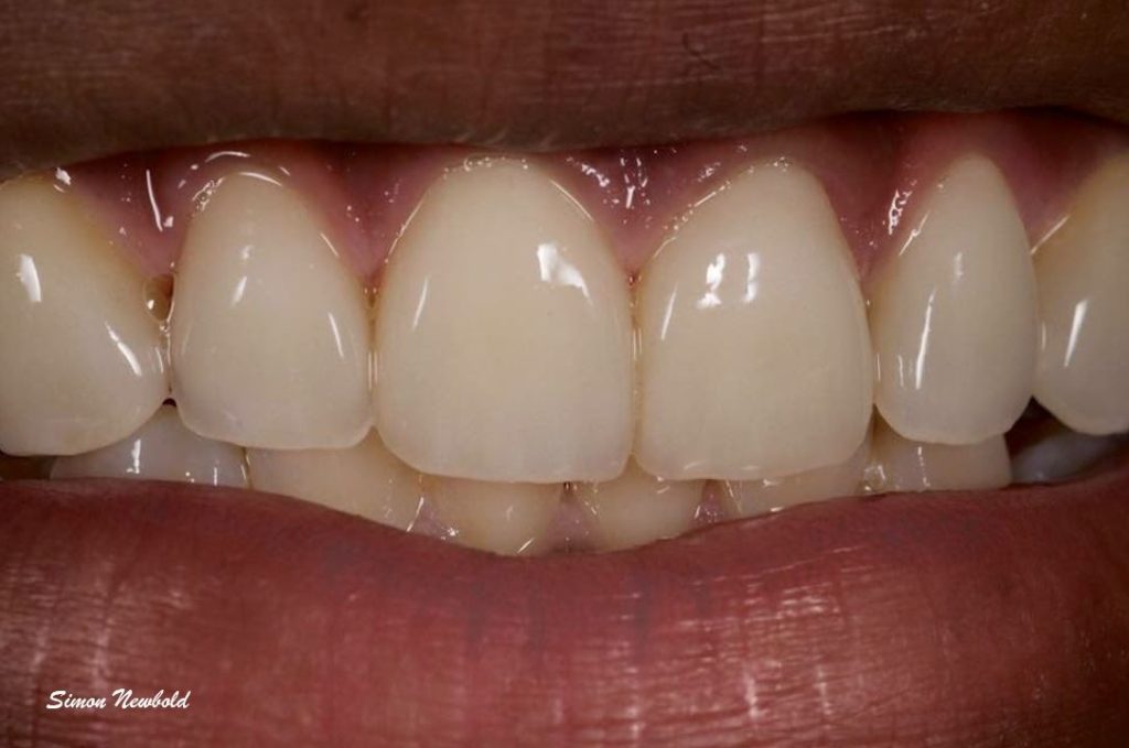 Creation - Ceramet UK Dental Solutions