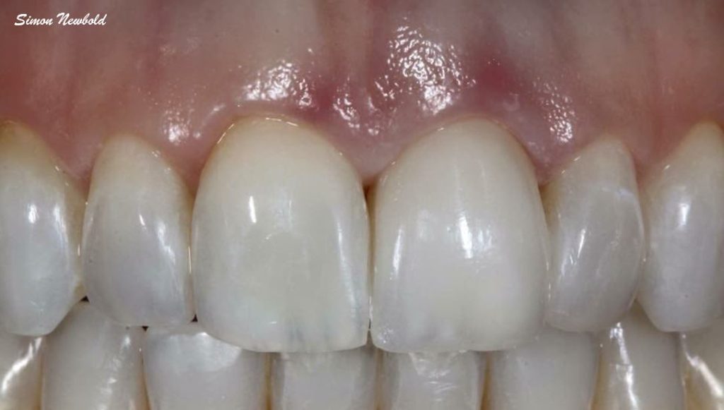 Creation - Ceramet UK Dental Solutions